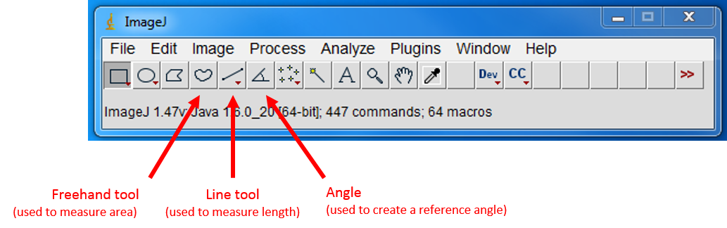 ImageJ toolbar annotated – Swallowing Rehabilitation Research Lab